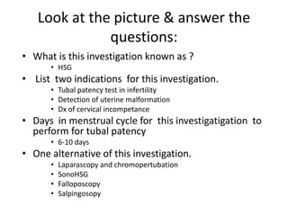 Obgyn.pptx | Pregnancy | Reproductive Health