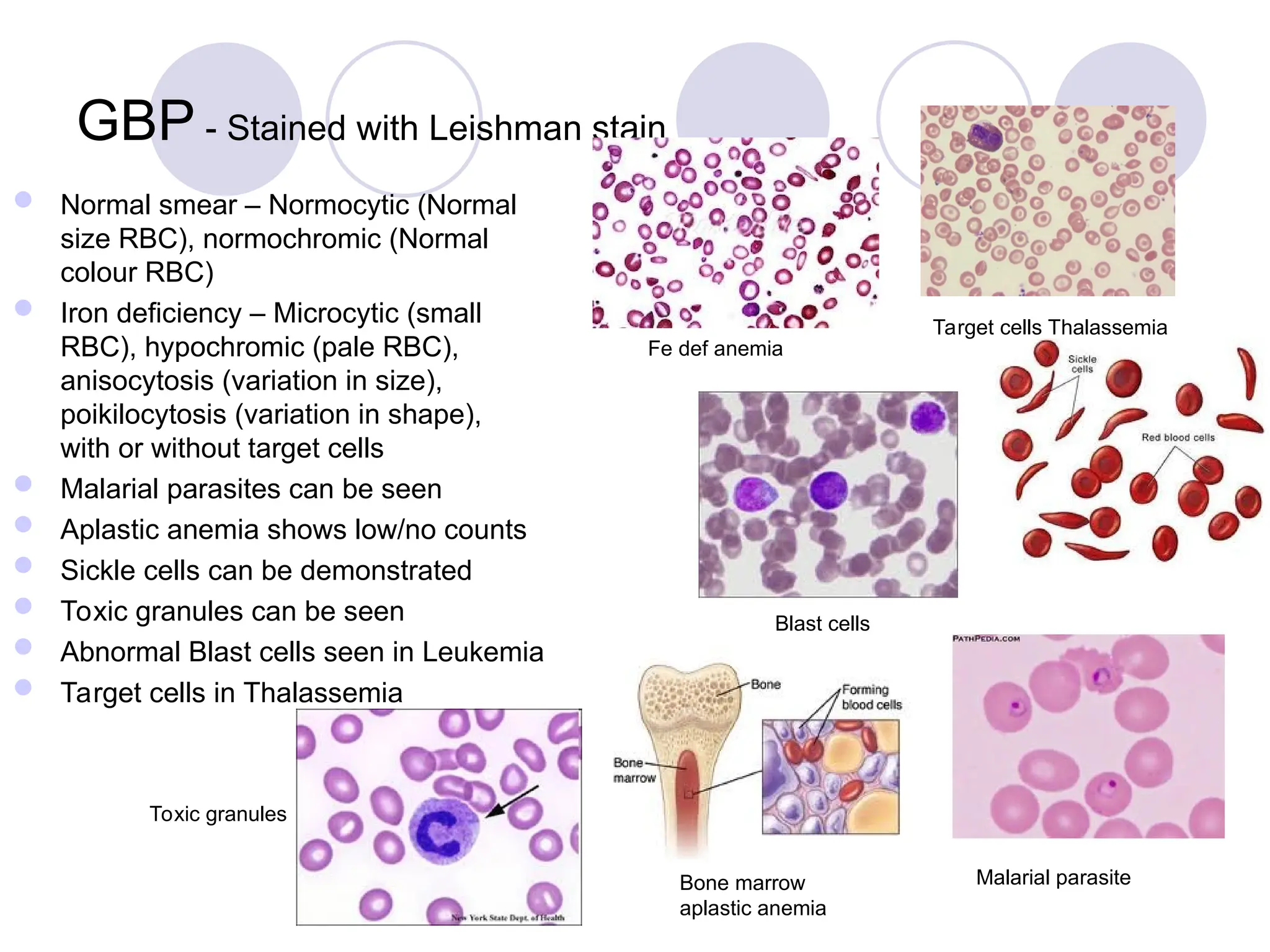 obgyn_anemia_in_pregnancy classification .ppt