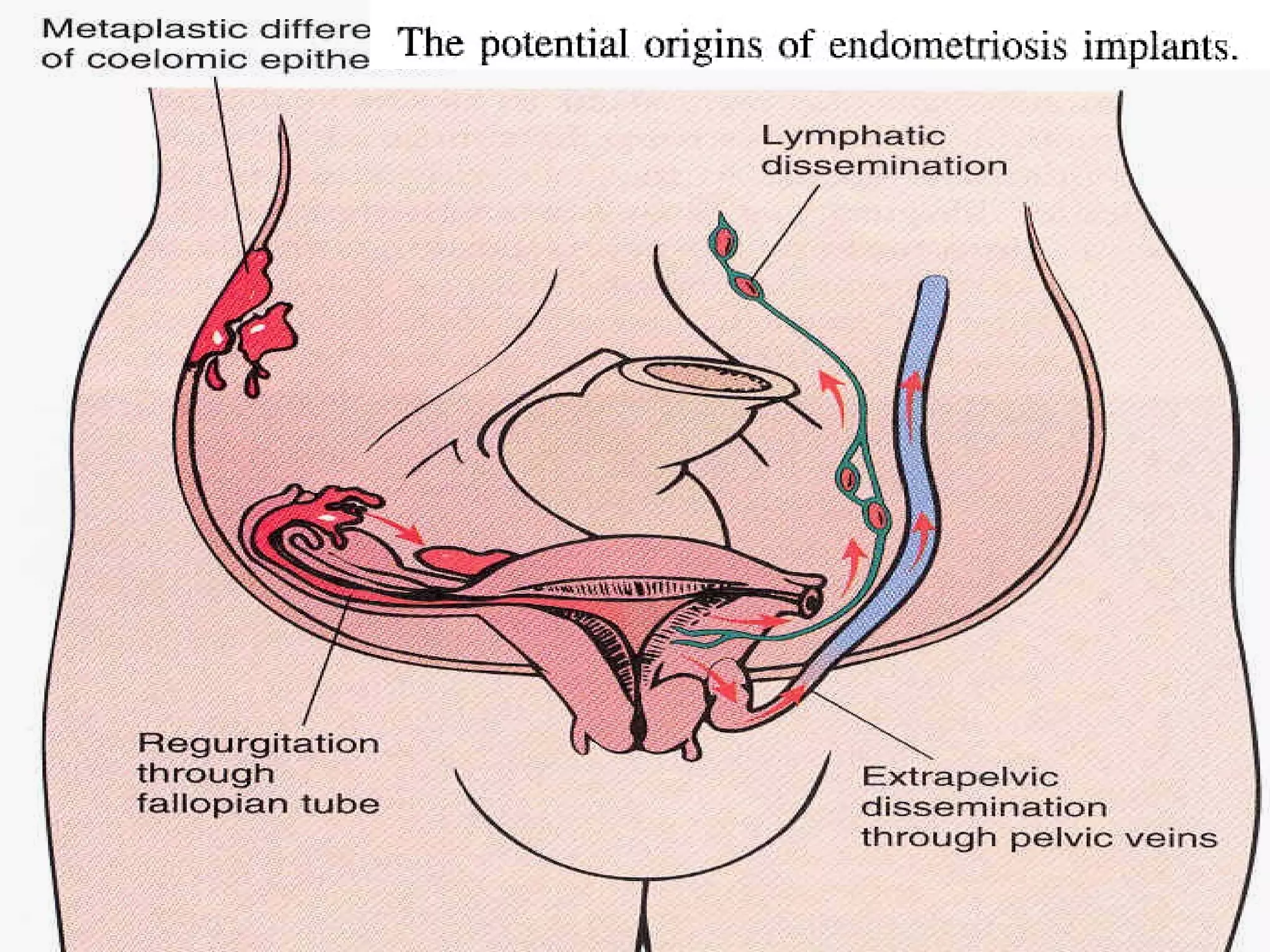 Obgyn Gyn Problems Ii | PPT