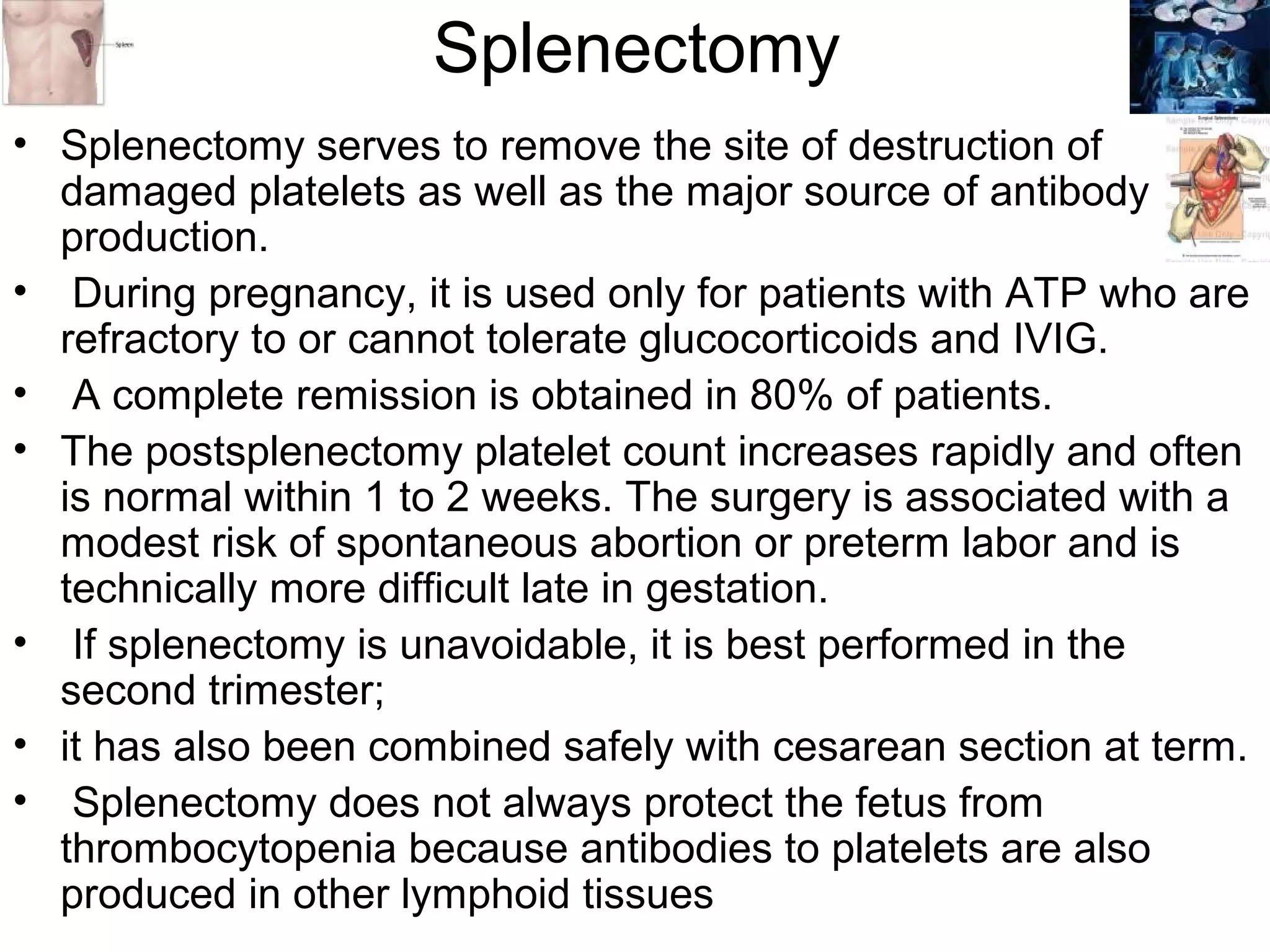 idiopathic thrombocytopenic purpura | PPT