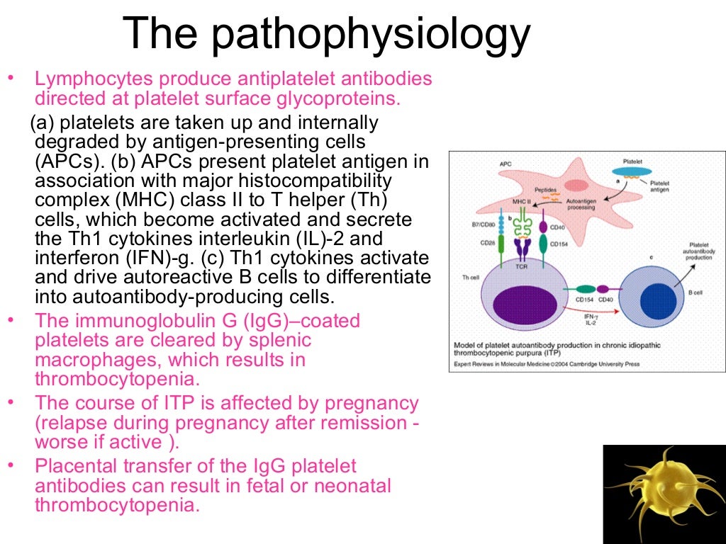 idiopathic thrombocytopenic purpura