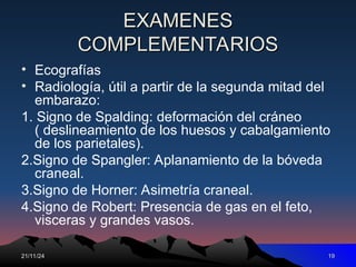 óbito fetal en ginecologíaóbito fetal en ginecología | PPT