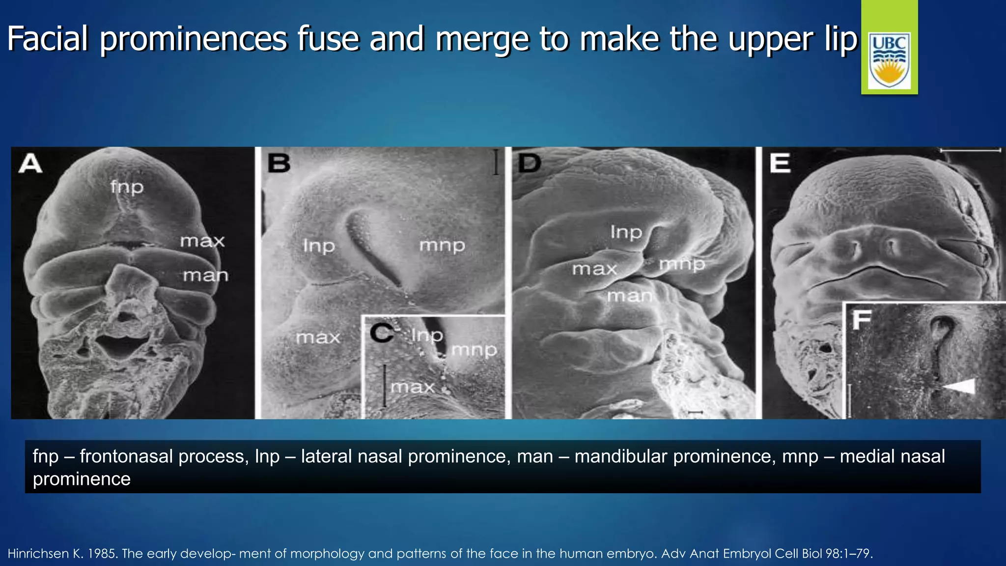 Facial Prominences | PPTX