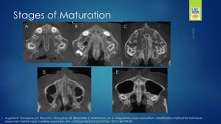 Sutures of the Skull | PPTX