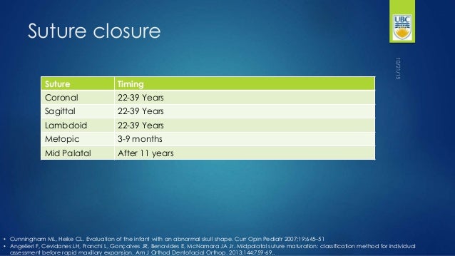 Sutures of the Skull