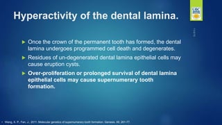 Supernumerary Teeth | PPTX