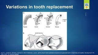 Supernumerary Teeth | PPTX