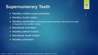 Supernumerary Teeth | PPTX