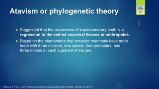 Supernumerary Teeth | PPTX