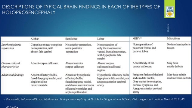 Holoprosencephaly