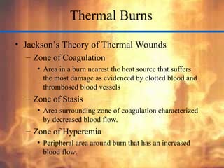 Objective 60, Burns PP.PPT in adults and children | PPT
