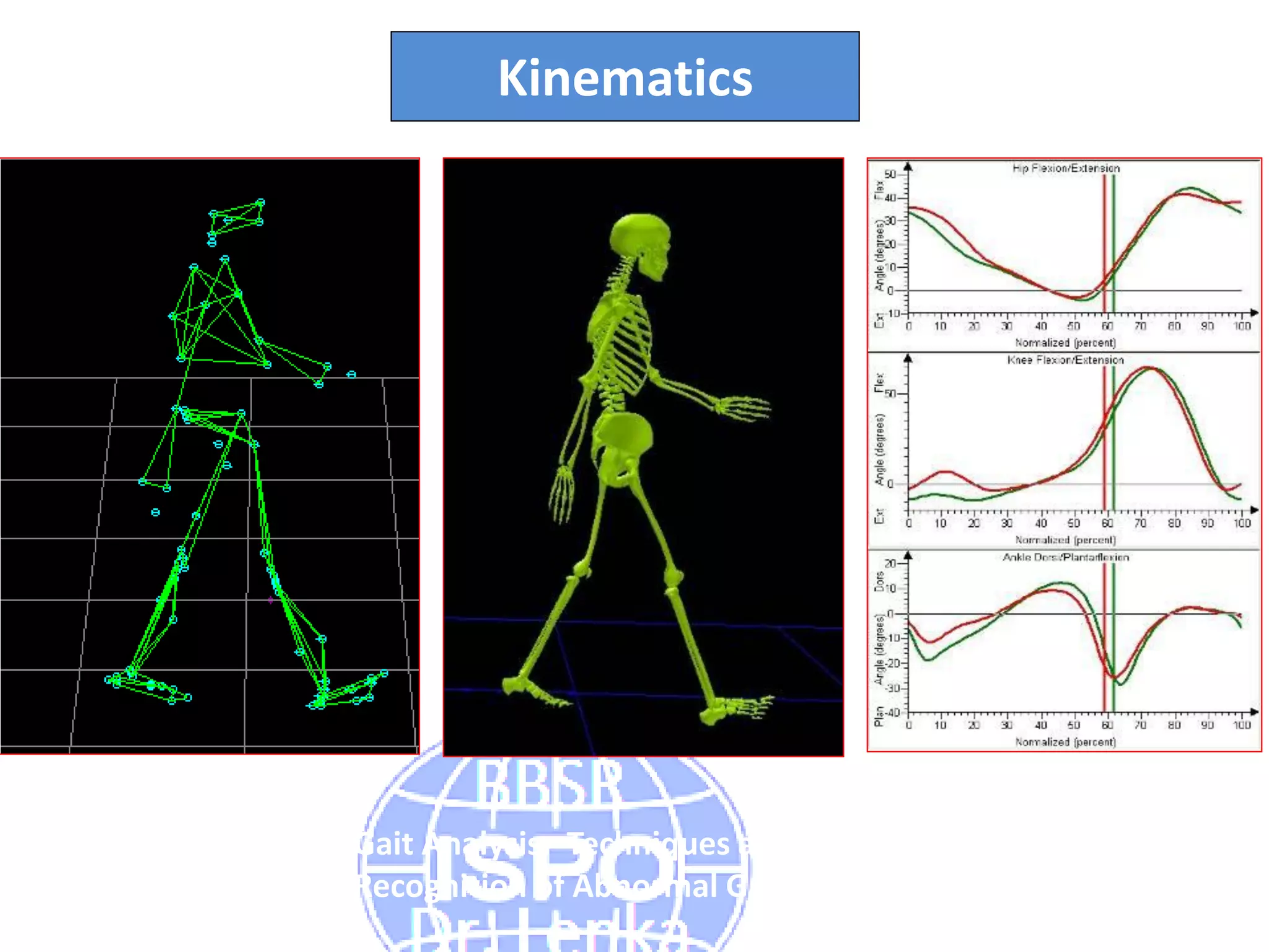 Kinetics and Kinematics Paramters in Gait | PDF