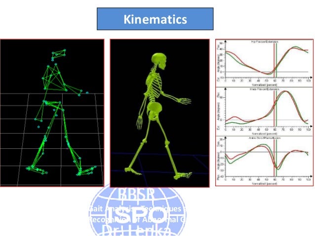 Kinetics And Kinematics Paramters In Gait