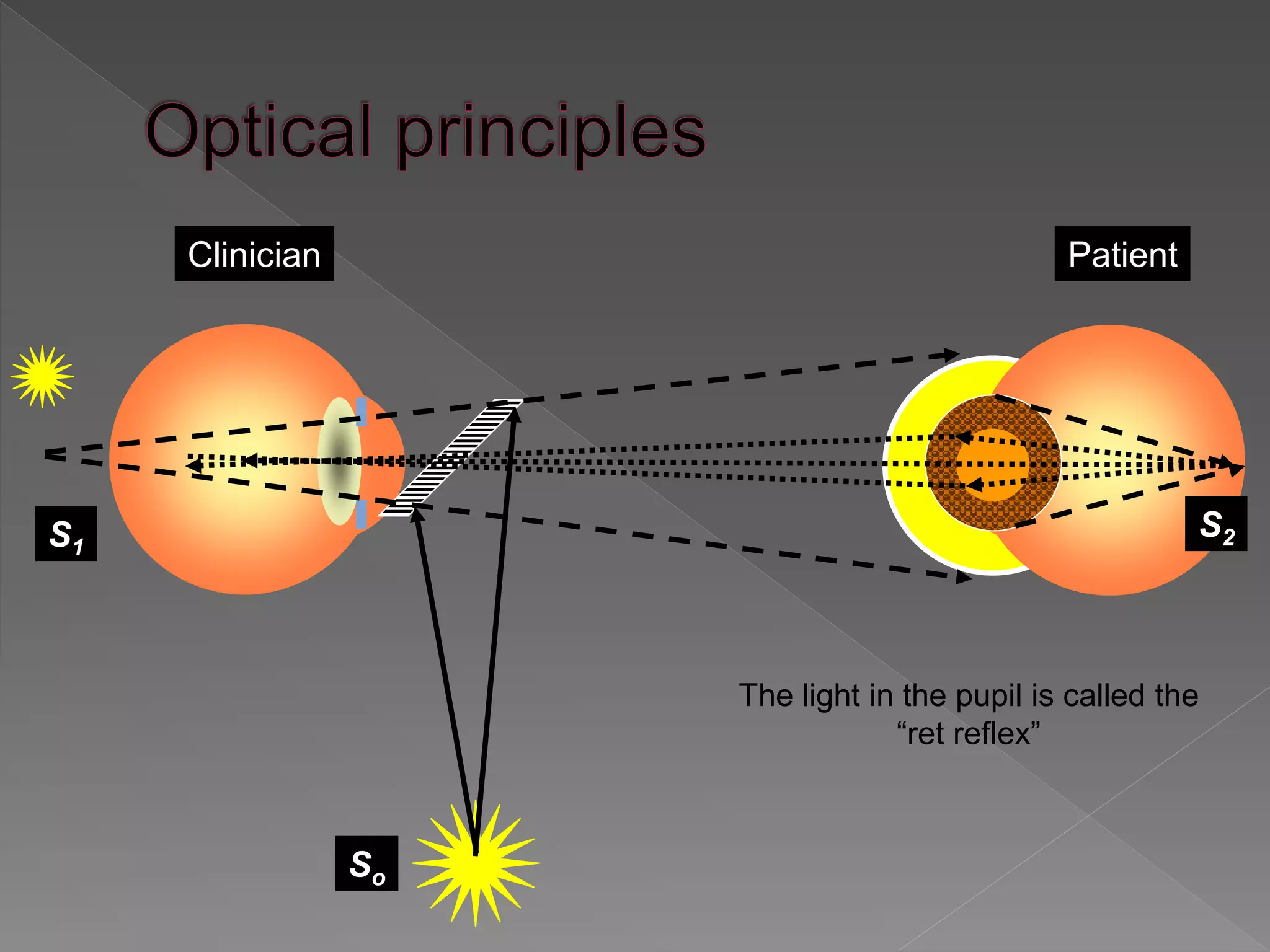 Objective refraction | PPTX