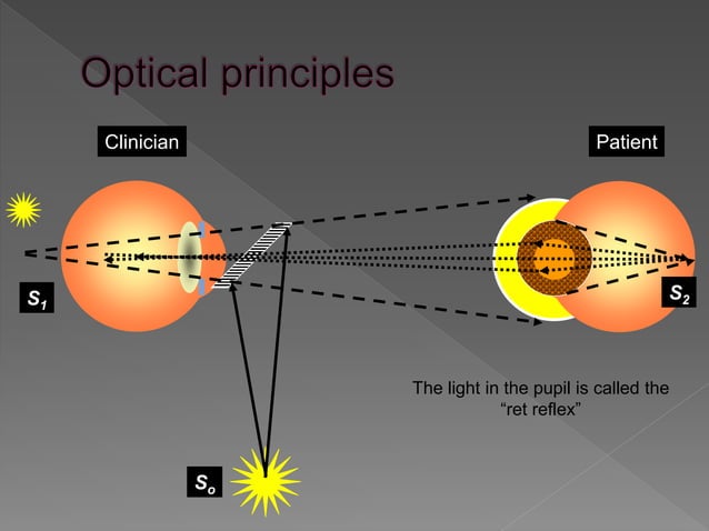 Objective refraction | PPTX | Eye and Vision Conditions | Diseases and ...