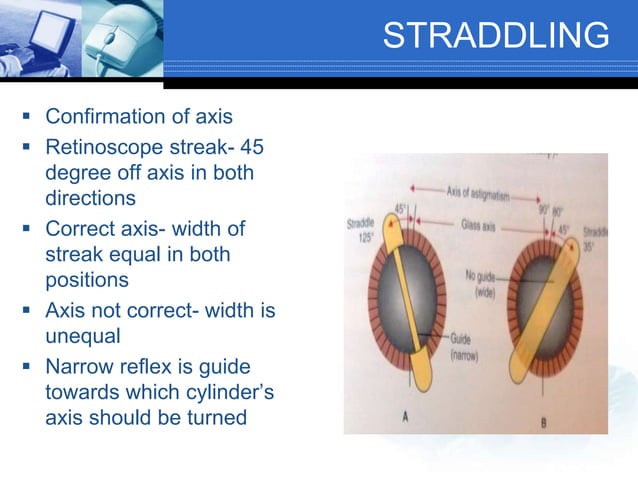 Objective refraction | PPTX | Eye and Vision Conditions | Diseases and ...