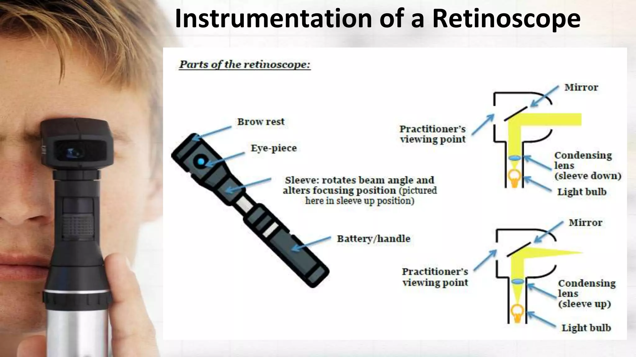 Objective retinoscopy | PPTX