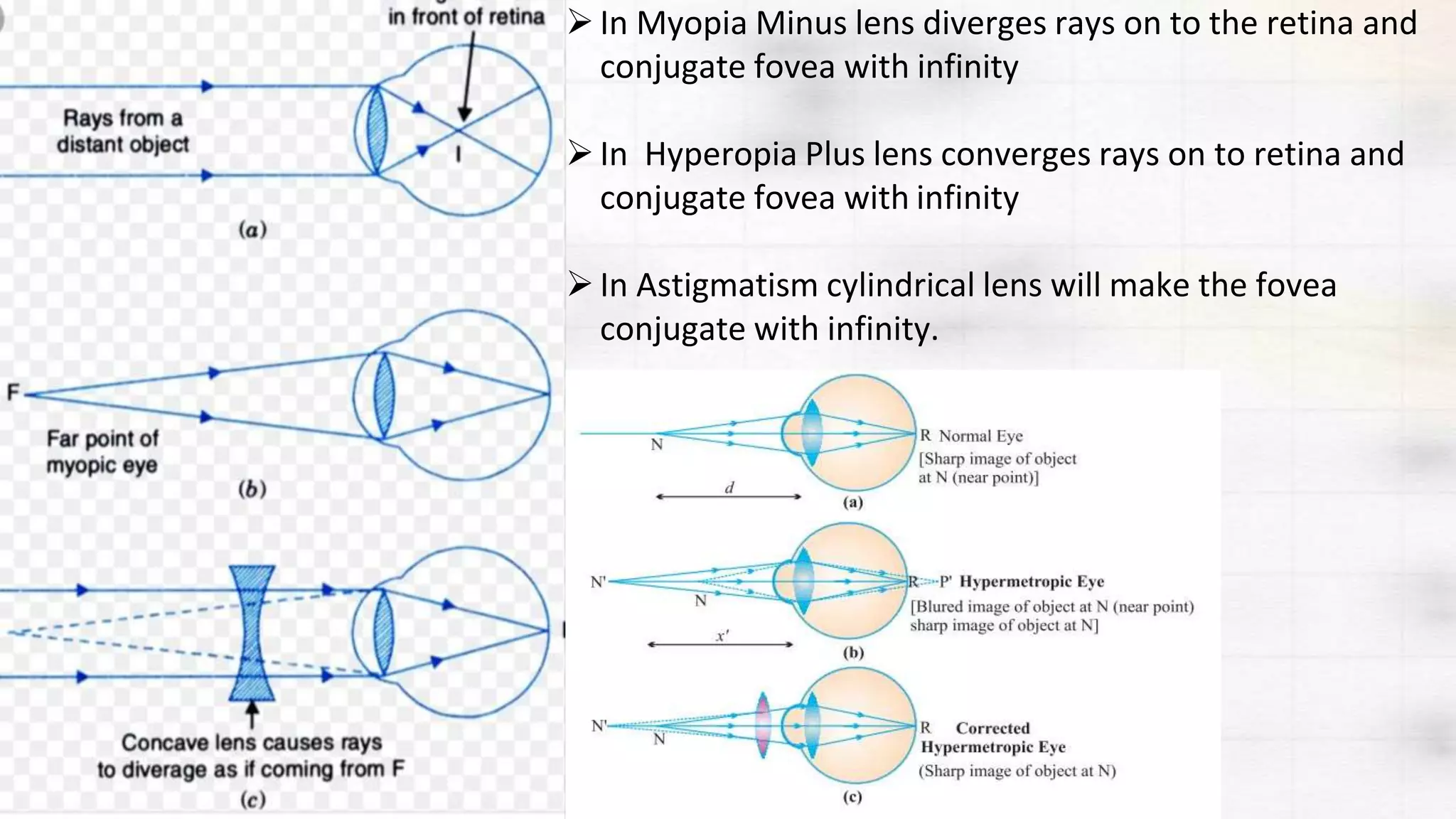 Objective retinoscopy | PPTX