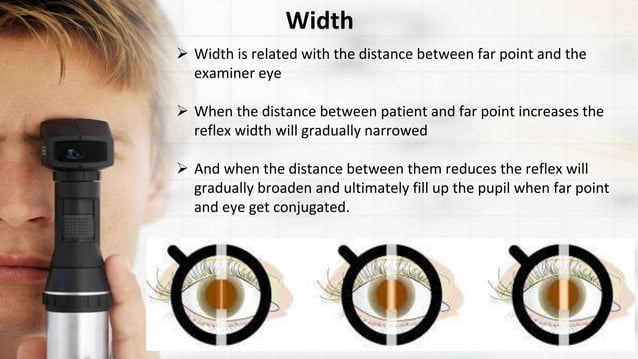Objective retinoscopy | PPTX