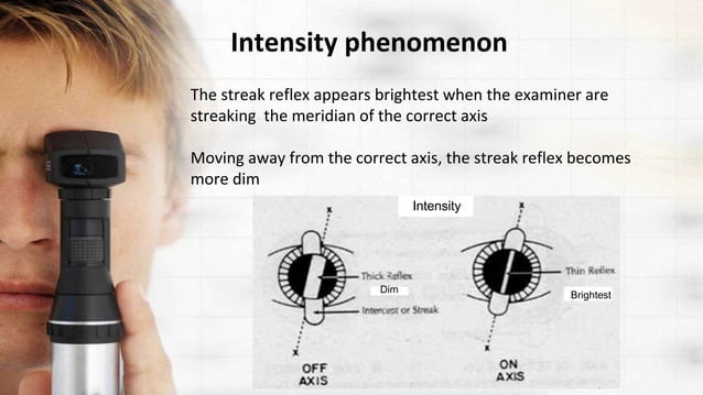 Objective retinoscopy | PPTX