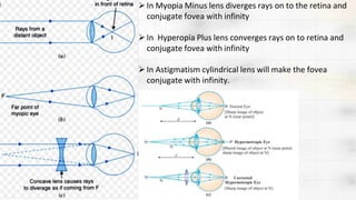 FP12 Correlation Between Retinoscopy And Monocular, 50% OFF