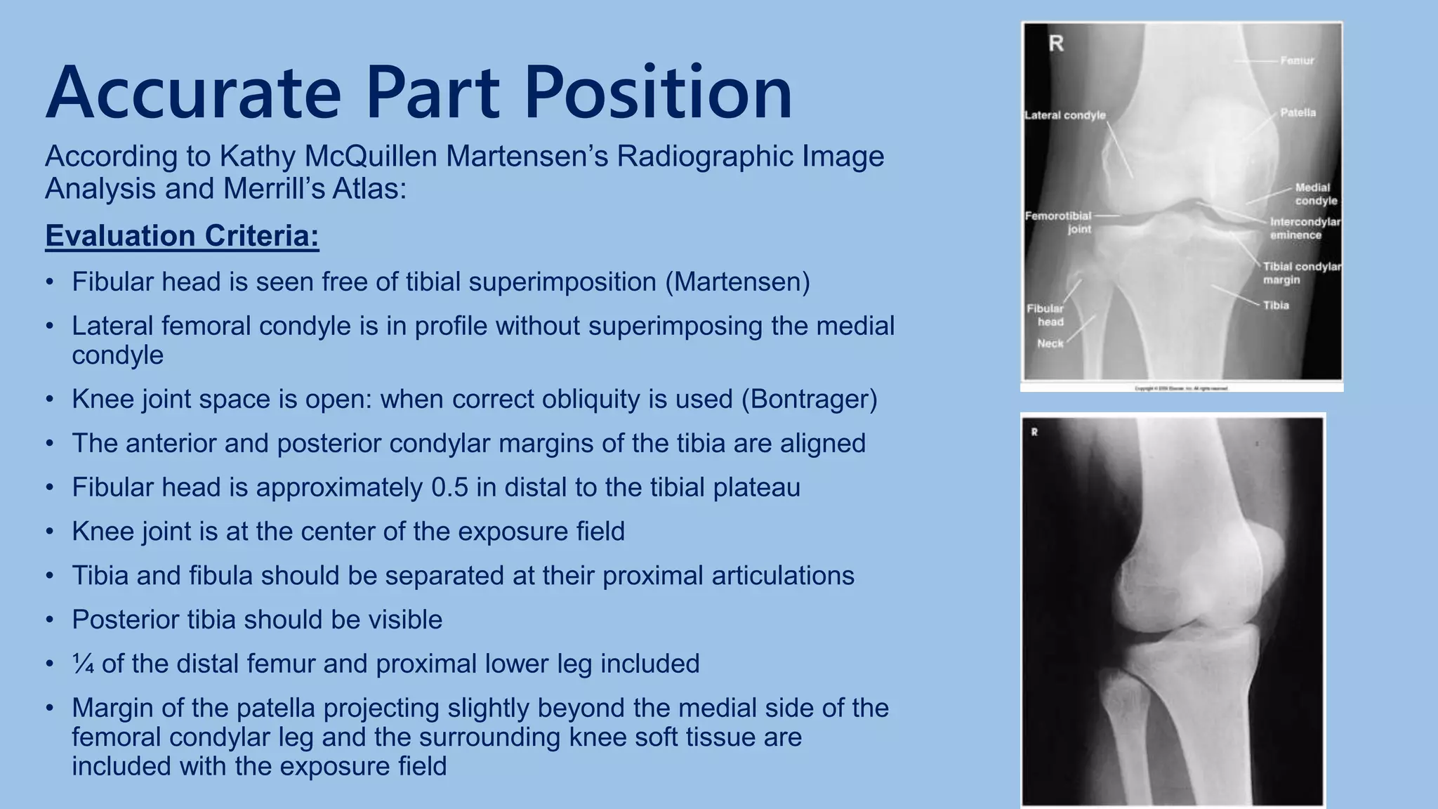 Oblique knee final evaluation | PPTX