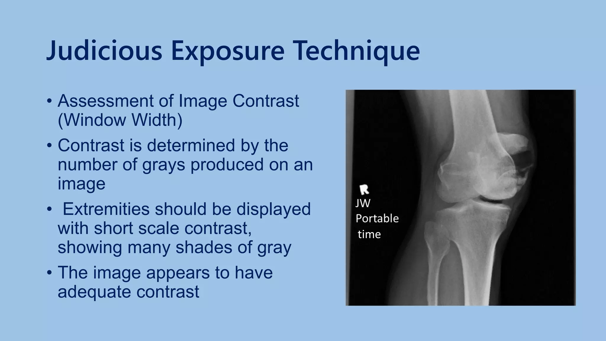 Oblique knee final evaluation | PPTX