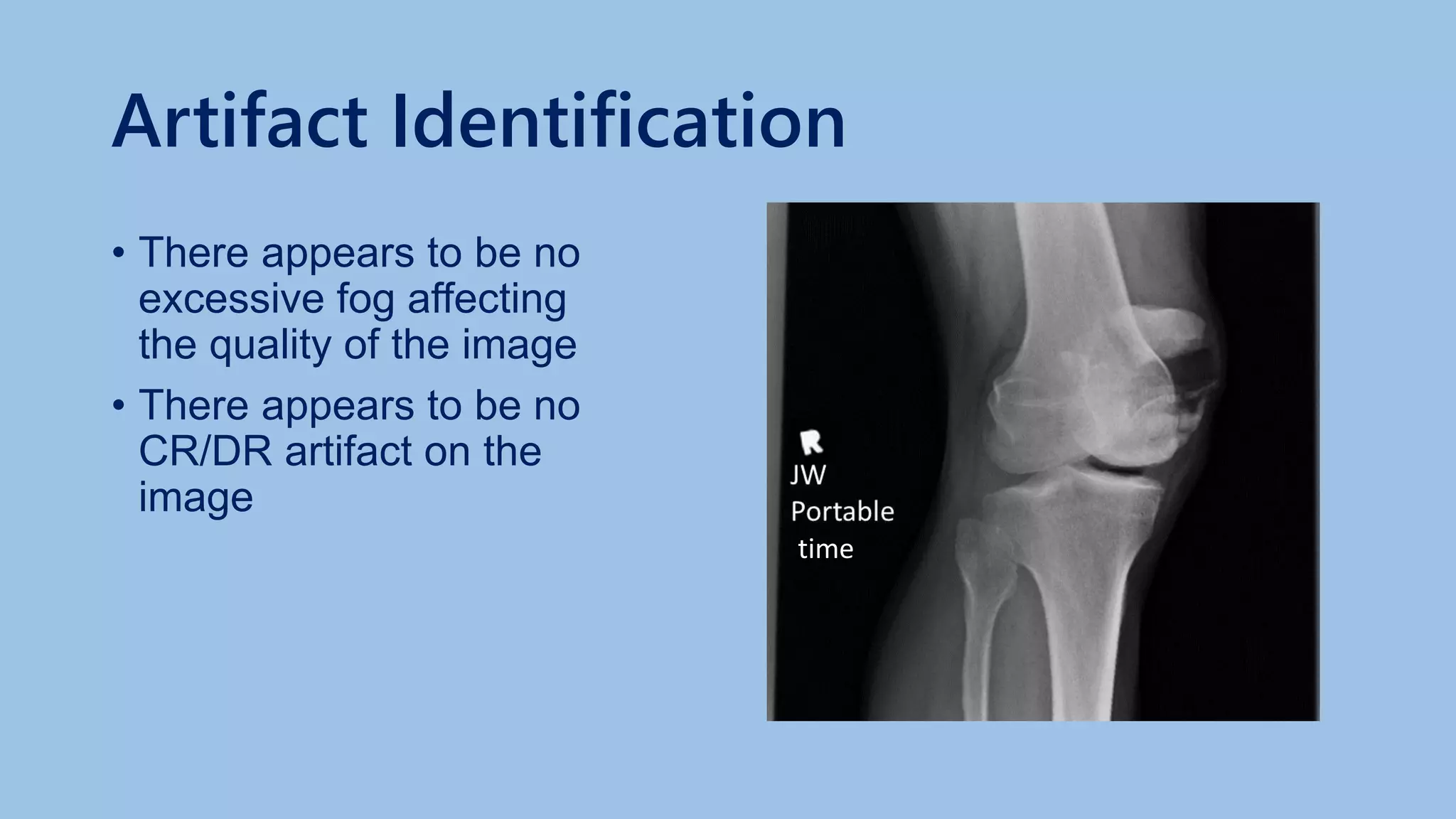 Oblique knee final evaluation | PPTX