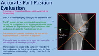 Oblique knee final evaluation | PPTX