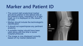 Oblique knee final evaluation | PPTX