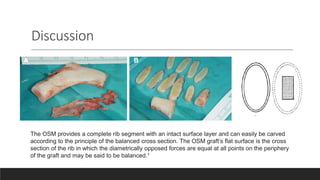 Oblique Split Method Rib Cartilage Tastan | PPT