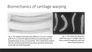 Oblique Split Method Rib Cartilage Tastan | PPT