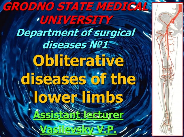 Obliterative diseases of the lower limbs (lecture vasilevsky v.p | PDF ...