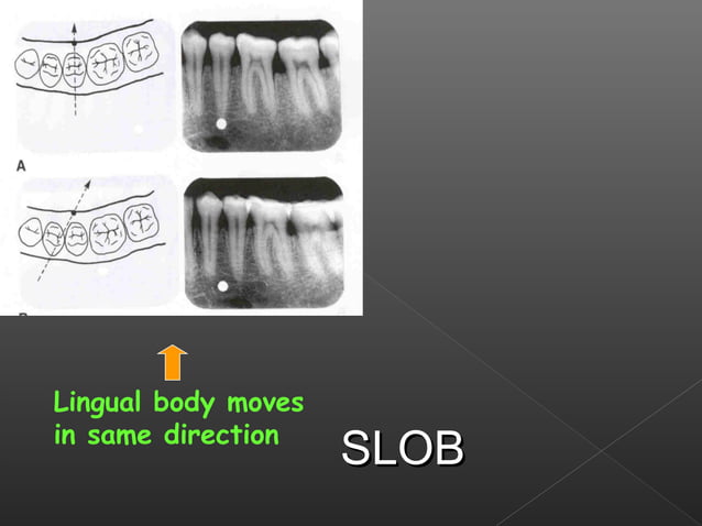Object localisation in dentistry | PPT | Dental Health | Diseases and ...