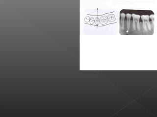 Object localisation in dentistry | PPT