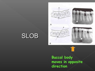 Object localisation in dentistry | PPT