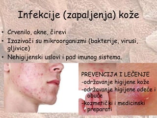 Oboljenja kože | PPTX