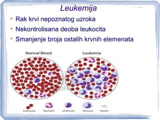 Oboljenja krvnog sistema, prva pomoć i reanimacija | PPT