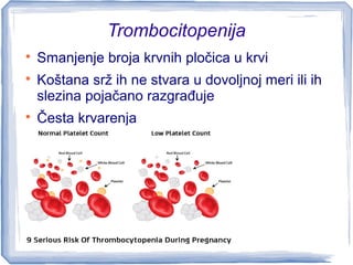 Oboljenja krvnog sistema, prva pomoć i reanimacija | PPT