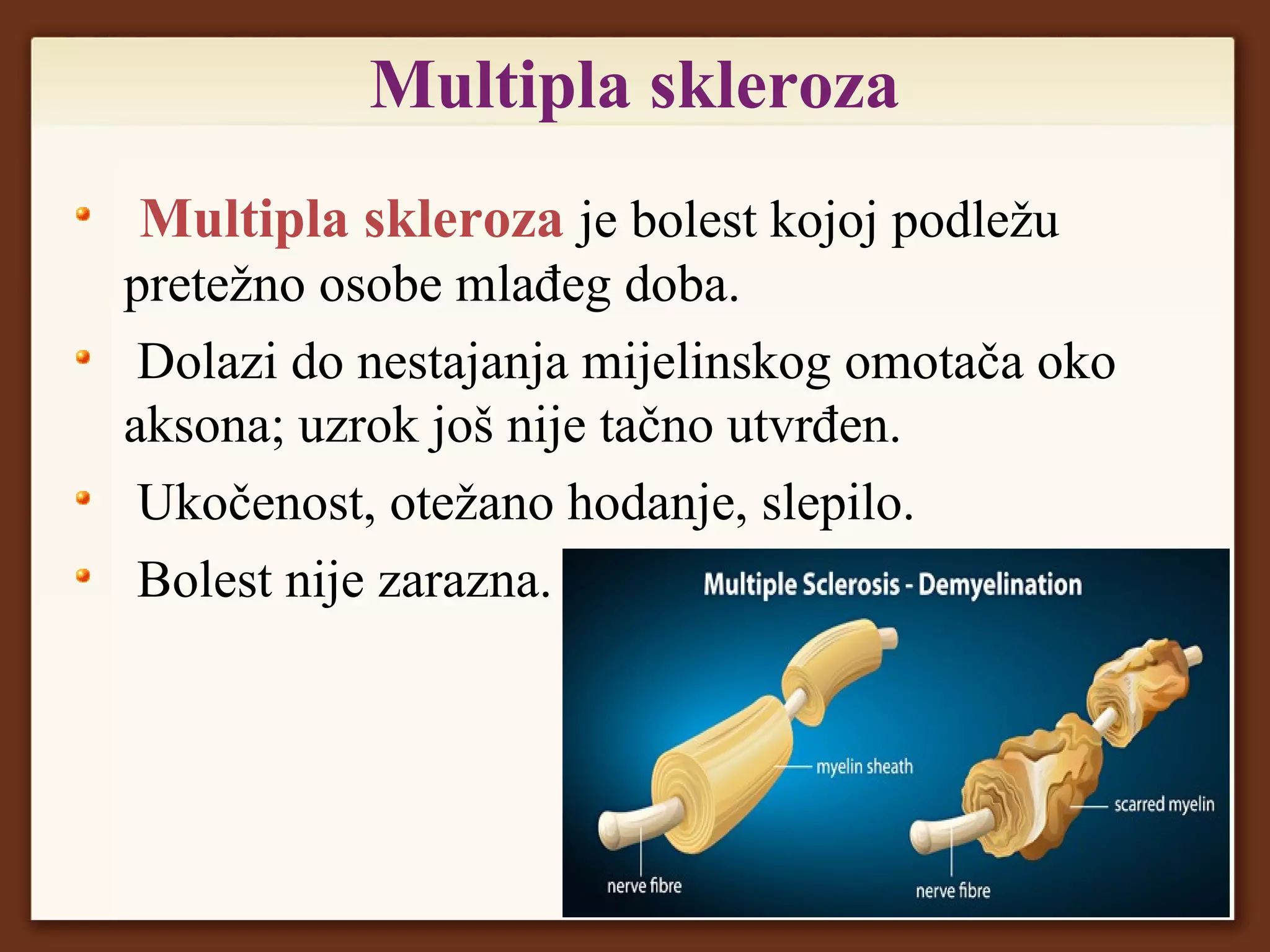 Oboljenja nervnog sistema | PPT