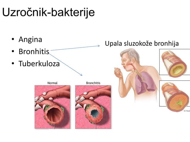 Oboljenja i zdravlje organa za disanje | PPTX