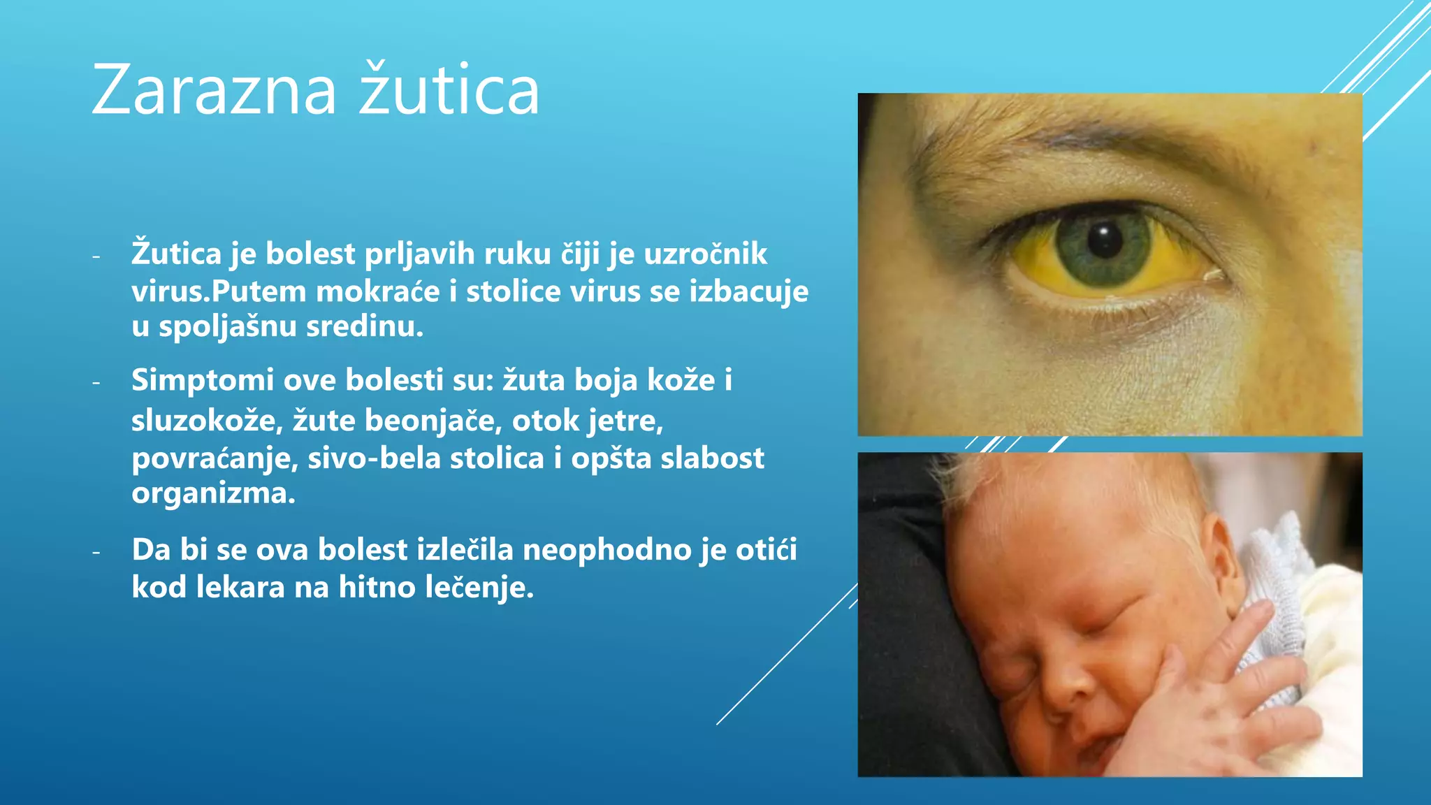 Oboljenja sistema organa za varenje | PPTX