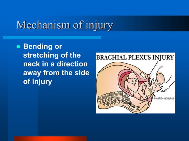 Obstetric Brachial Plexus Palsy | PPT | Pregnancy | Reproductive Health