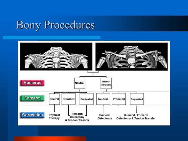 Obstetric Brachial Plexus Palsy | PPT | Pregnancy | Reproductive Health