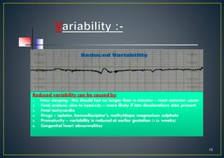Obs(cardiotocography) | PPTX