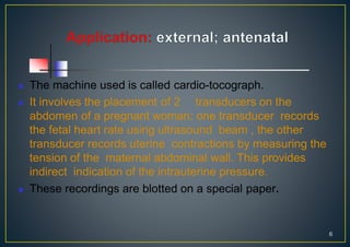 Obs(cardiotocography) | PPT