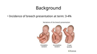Obs emergencies breech and bleeding .pptx