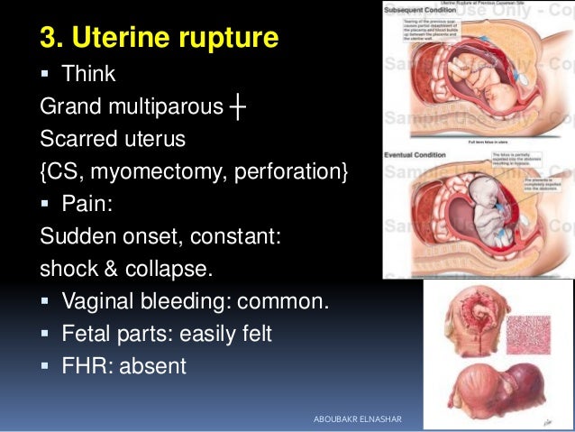Common Obstetrical and Gynecological Emergencies