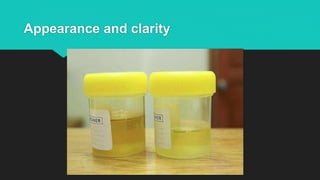 Observation of stools, urine, and sputum | PPT