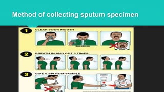 Sputum Sample Collection